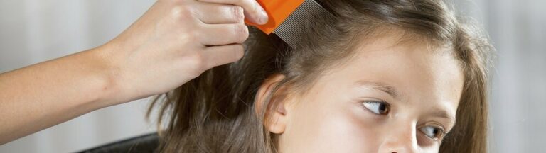 Vši a hnidy na hlave | lekar.sk