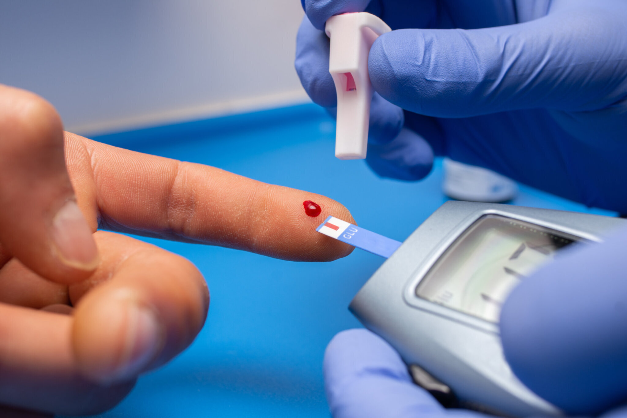 Glykémia – Hladina cukru v krvi | lekar.sk